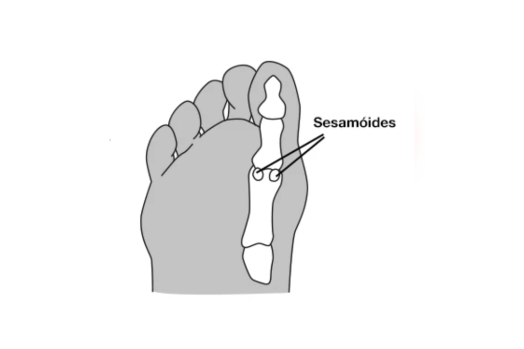 O que é o osso sesamoide? - onfeet